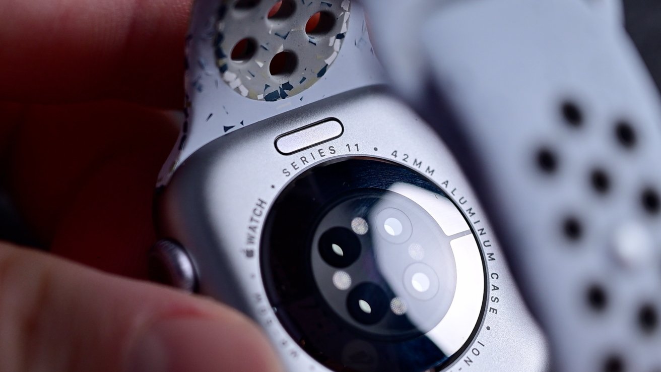 Apple Watch Series 11 review: Features, Specs, Price